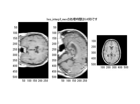 Matlab Coderでmex化