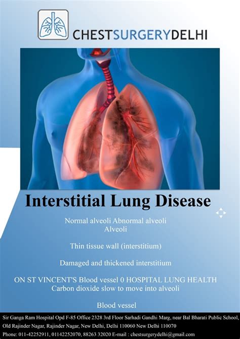 Interstitial Lung Disease Normal Alveoli Abnormal Alveoli Alveoli Thin