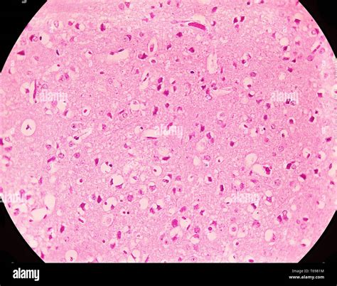 Magnified 300x This Photomicrograph Of Mouse Brain Tissue After Dying