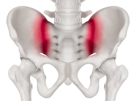Sacroiliac Joint Dysfunction Dr Yu Chao Lee Adelaide