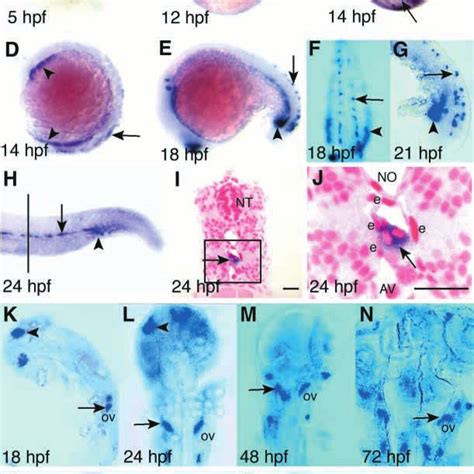 Effects Of Runx1 Expression In Cloche Abd F And Wild Type C