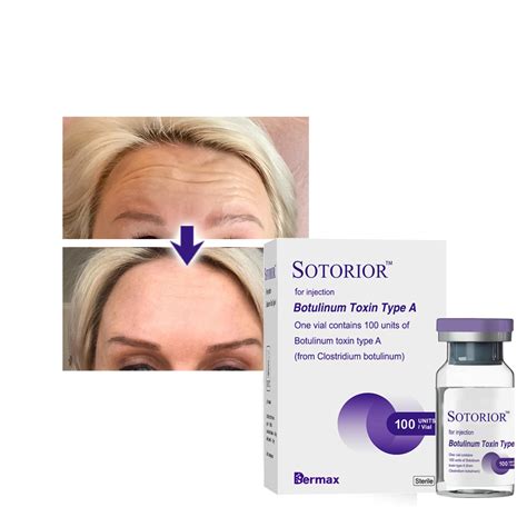 What Does Botulinum Toxin Do To The Body