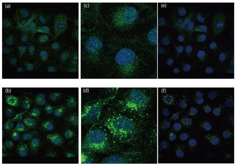 Gpcr Internalization Analysis Yokogawa Electric Corporation
