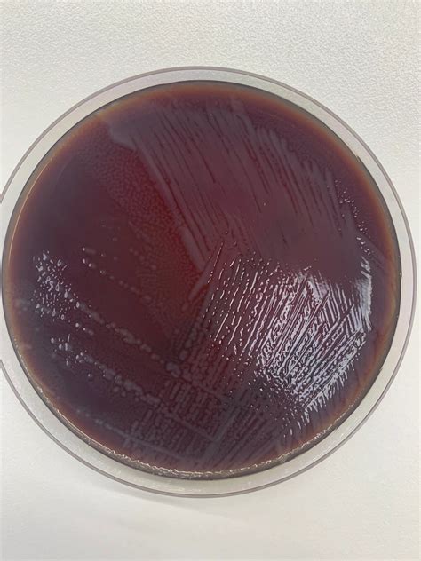 奇异变形杆菌药敏分享