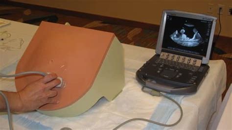 Paracentesis Course Hospital Procedures Consultants
