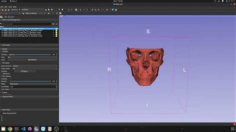 Amasss Automatic Multi Anatomical Skull Structure Segmentation Youtube