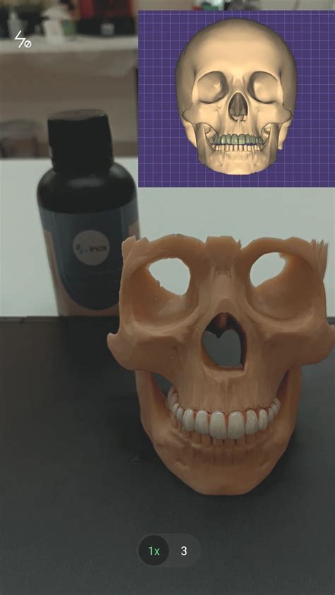 Yahya Salman On Linkedin Design Exocad