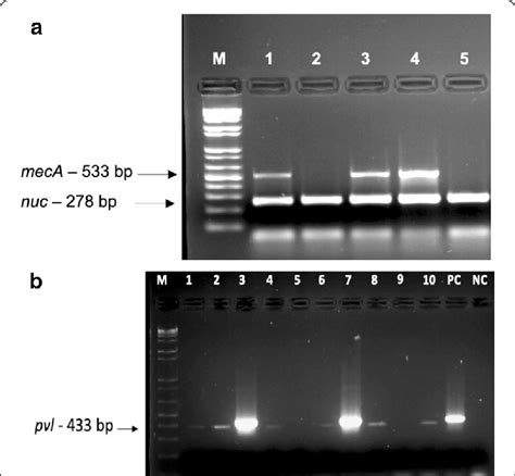 Pcr Detection Of Nuc Meca And Pvl Genes A Multiplex Pcr For Download Scientific Diagram