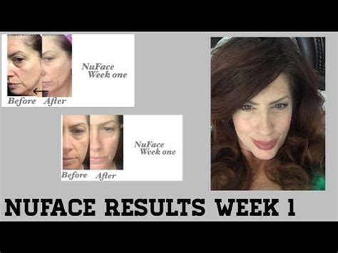 NuFace Review Week 1 YouTube