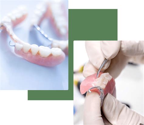 Partial Dentures Schaefer Denture Clinic