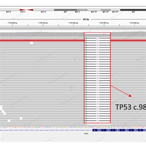 Ngs Assay Results Genetic Sequencing Analysis Of Tumor Tissue From Cr Download Scientific