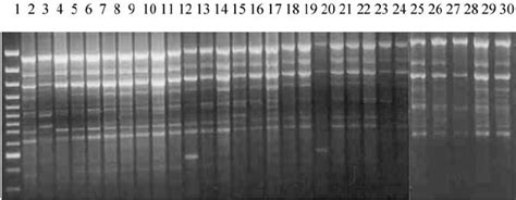 Rapd Profile Of 29 Accessions Of Neem Using Primer Opc 08 Lane1 Download Scientific Diagram