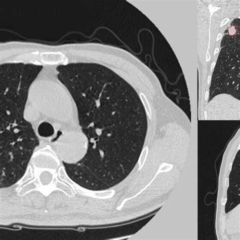 segmentation results under different views left axial top right
