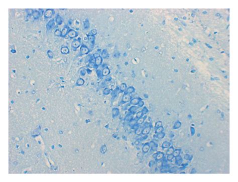 Nissl Staining Of The Hippocampus A Sham Operation Group B Model Download Scientific