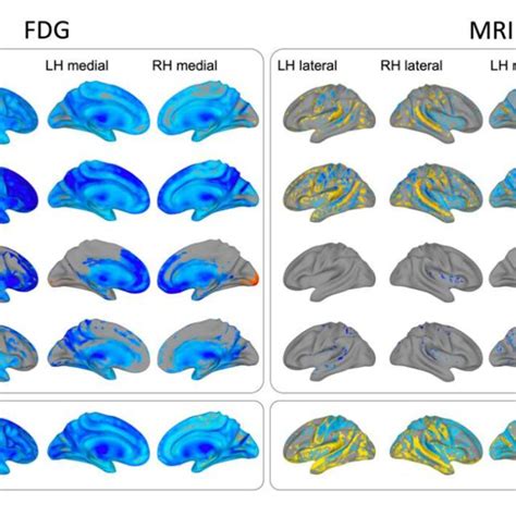 voxel wise linear regression analysis of brain age gap 764 765