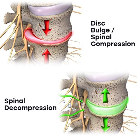 360 Physical Medicine Decompression Consultation