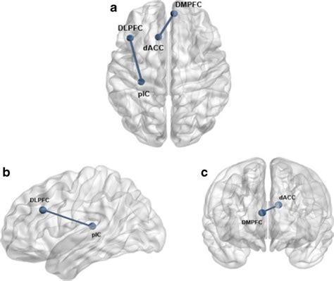 Resting State Functional Connectivity A Results Of The Roi Based Download Scientific Diagram