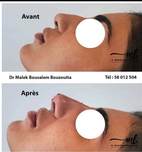 صور📸قبلوبعد شغل Dermalife Clinic عيادة ديرما لايف Facebook