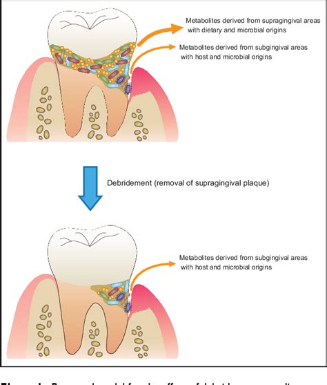 Figure 1 From Prediction Of Periodontal Inflammation Via Metabolic Profiling Of Saliva