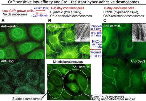 New Insights Into Desmosome Regulation And Pemphigus Blistering As A