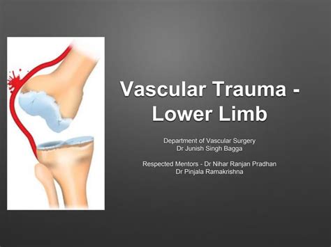 Lower Limb Vascular Trauma Brief Pptx