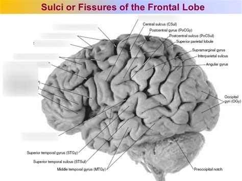 Inferior Frontal Sulcus