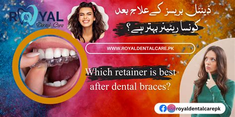 Which Retainer Is Best After Dental Braces Royal Dental Care