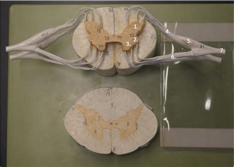 Spinal Cord Model Diagram Quizlet