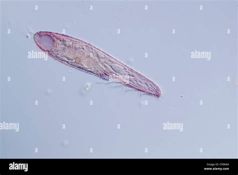 Blepharisma 100x