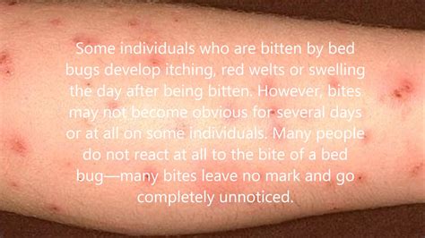 How To Identify Bed Bug Bites Orkin Canada
