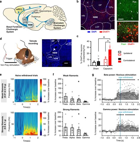 Recruitment Of The Nucleus Basalis Of Meynert Nbm A Basal Forebrain Download Scientific