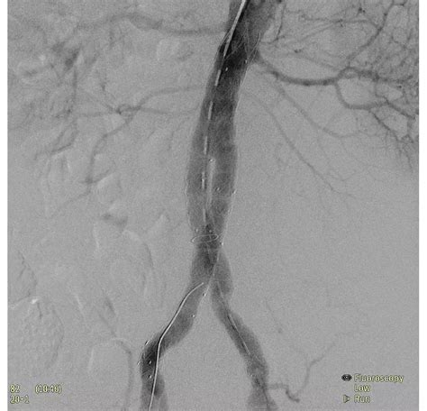 Philips Zenition 70 Circular Edition Hc889150