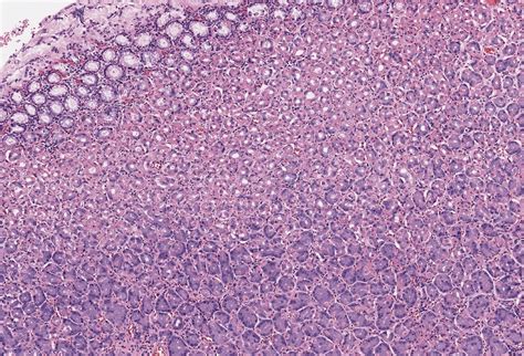 Pathology Outlines Anatomy And Histology