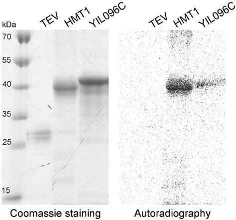 Putative Mtase Yil096c Binds Adomet Purified Yil096c With Download Scientific Diagram