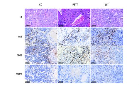 Expression Of Cd8 Cd68 And Foxp3 In Different Types Of Gestational Download Scientific