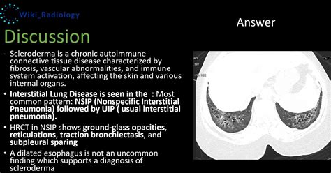 Wiki Radiology Wiki Radiology Added A New Photo