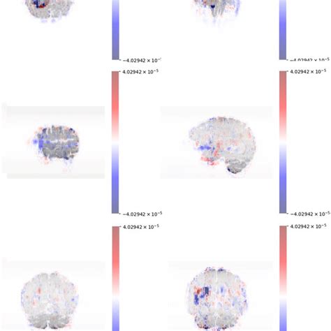 Example Analysis Of The Shap Features A The Reference Flair Image Of Download Scientific