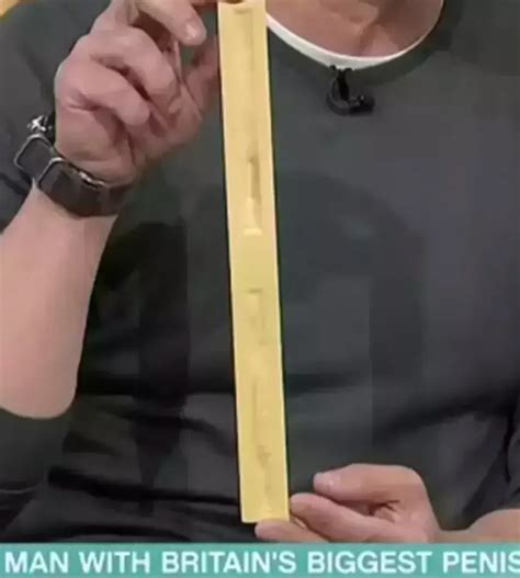 Brit With The Verified Worlds Biggest Penis Explains The Toll Its