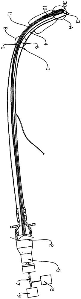 经鼻气管插管导芯的制作方法