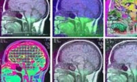 شخصیّت از دیدگاه روان کاوی