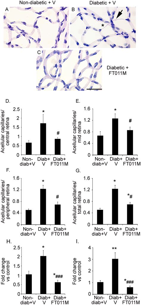 Ft011m Reduced Acellular Capillaries And Extracellular Matrix Proteins