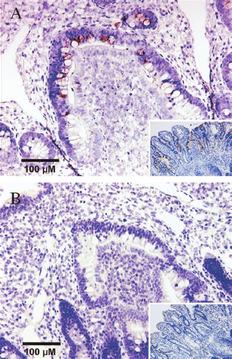 Localization Of Gro ␣ Transcripts In Bovine Ileal Peyers Patches By In Download Scientific