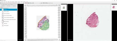 Qupath Point Aligment Image Analysis Imagesc Forum