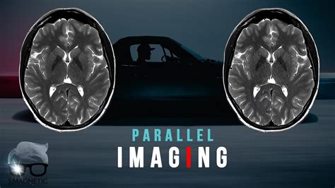 Parallel Imaging Mri How It Makes Your Scans Faster 2024 Wiki Scienceblog