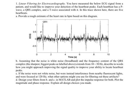Solved 1 Linear Filtering For Electrocardiography You Have