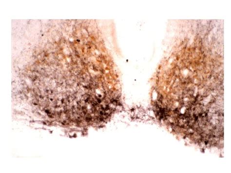 Light Scn Direct Via The Retinohypothalamic Rht Pathway