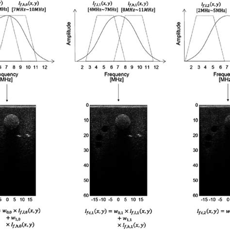Pdf Speckle Reduction Techniques In Medical Ultrasound Imaging