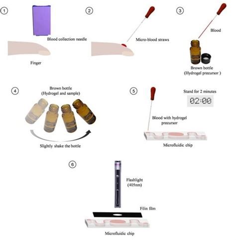 Microfluidic Point Of Care Device Uses Cloud Computing Ufluidix