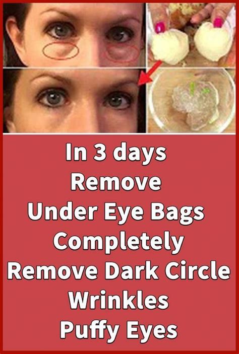 Remove The Dark Circles And Bags Under The Eyes With This Natural And
