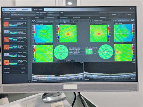 Optopol Revo Fc Oct With Angio Biometry For The Price Buy In Sky Optic